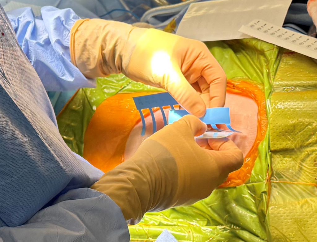 surgical skin – Clozex Medical, Inc.